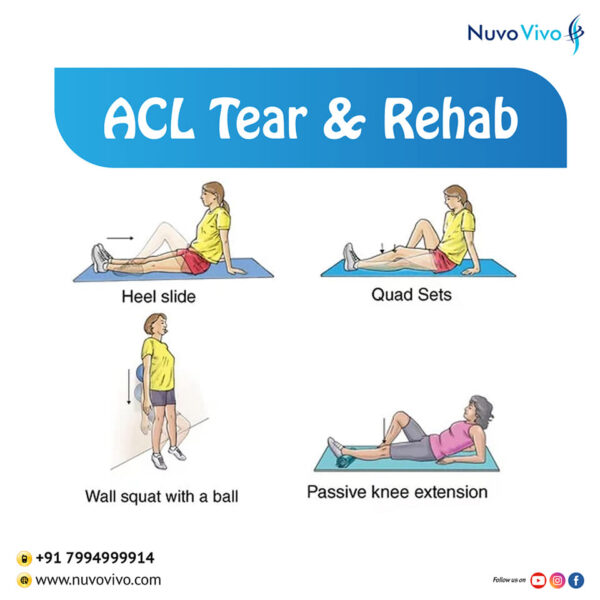 What is ACL Tear & how to reduce the pain? - NuvoVivo: Reverse Your Age ...